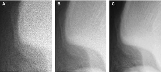 Quantum Mottle | HTM Wiki | Fandom powered by Wikia