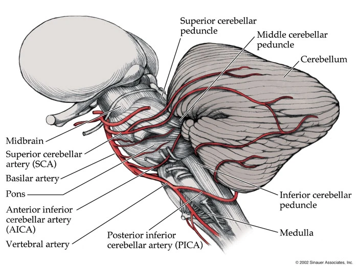 Arterial supply to brain:Cerebellar arteries (SCA, AICA, PICA ...
